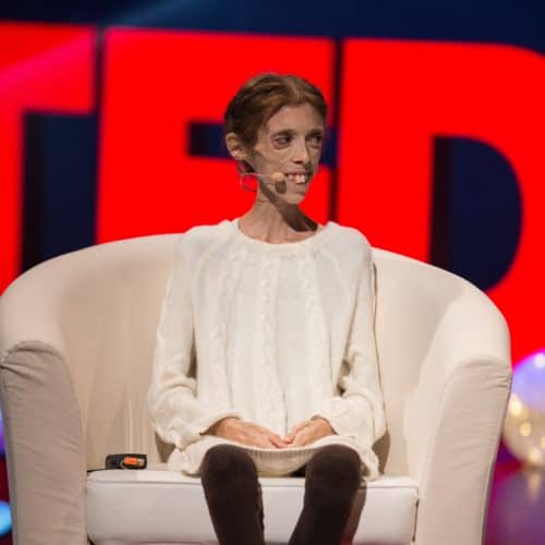 Lene Marie Fossen | Speaker TEDxArendal 2017